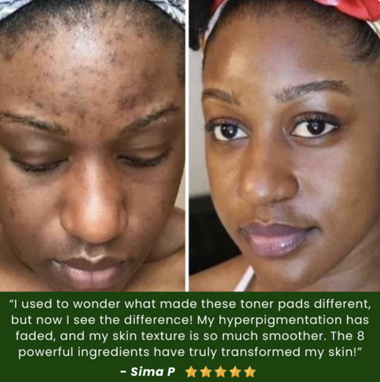 Jiyu Korean Toner Pads – isavelle